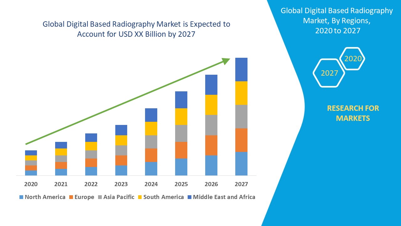 Digital Based Radiography Market – Global Industry Trends and Forecast ...